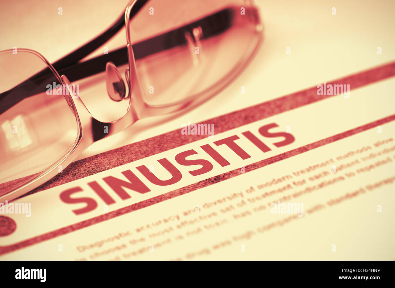 Sinusitis. Medicine. 3D Illustration Stock Photo - Alamy