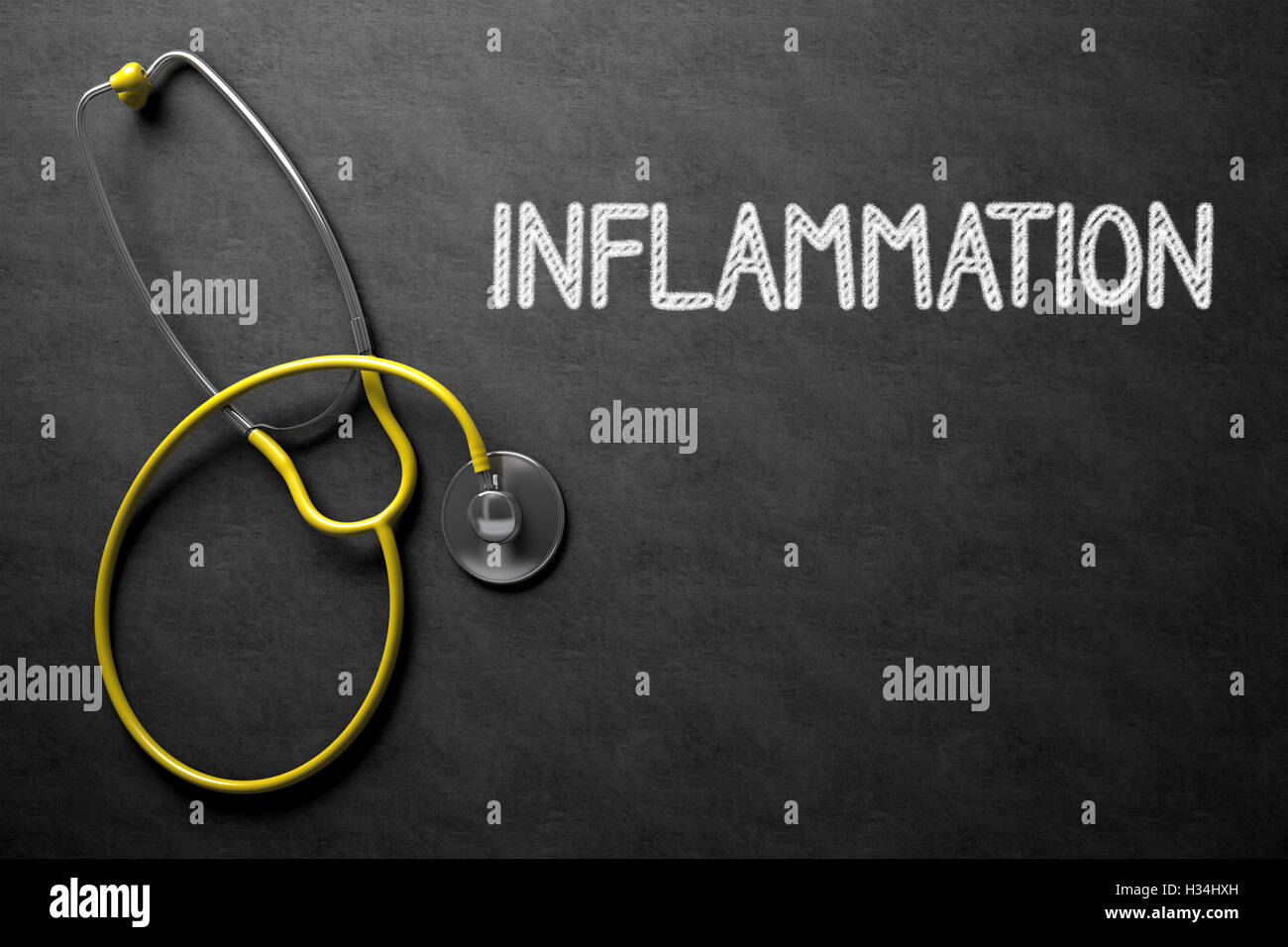 Chalkboard with Inflammation. 3D Illustration Stock Photo - Alamy
