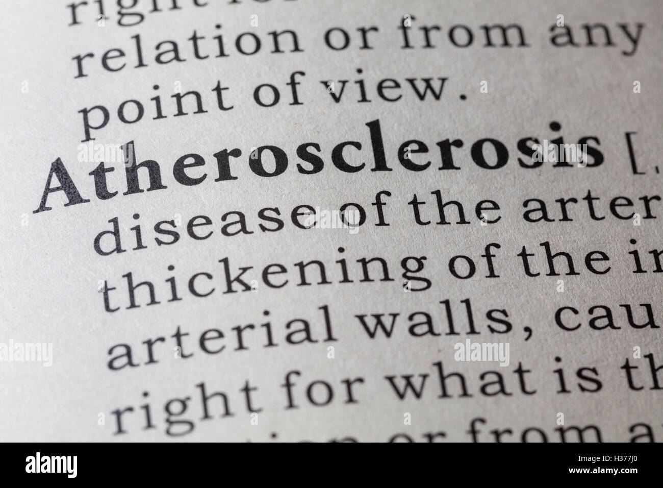 Atherosclerosis hi-res stock photography and images - Alamy