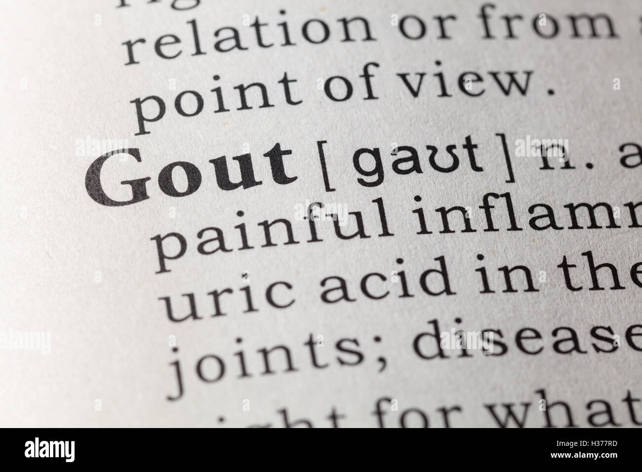 Gout hi-res stock photography and images - Alamy