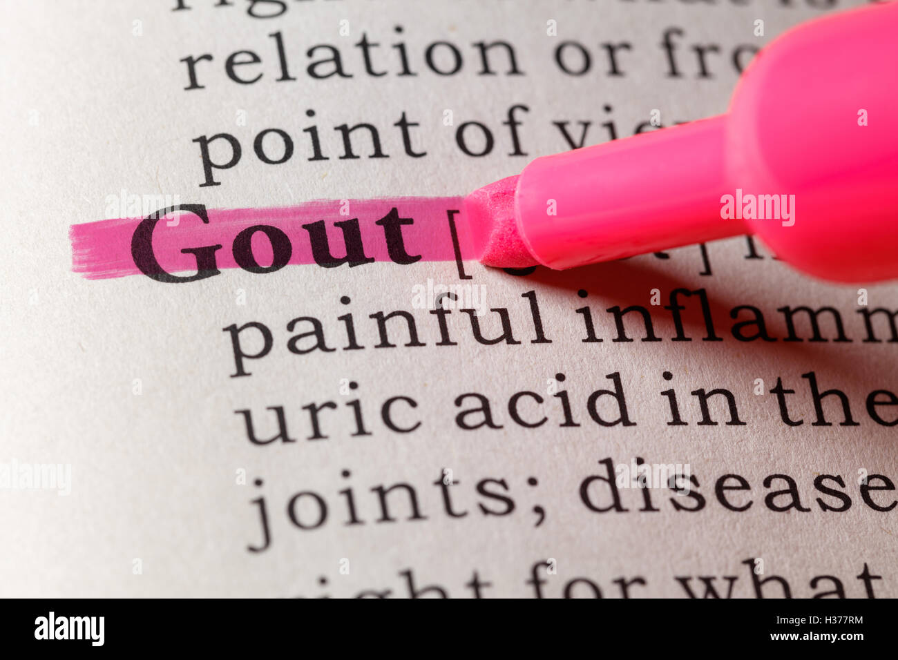 Gout hi-res stock photography and images - Alamy