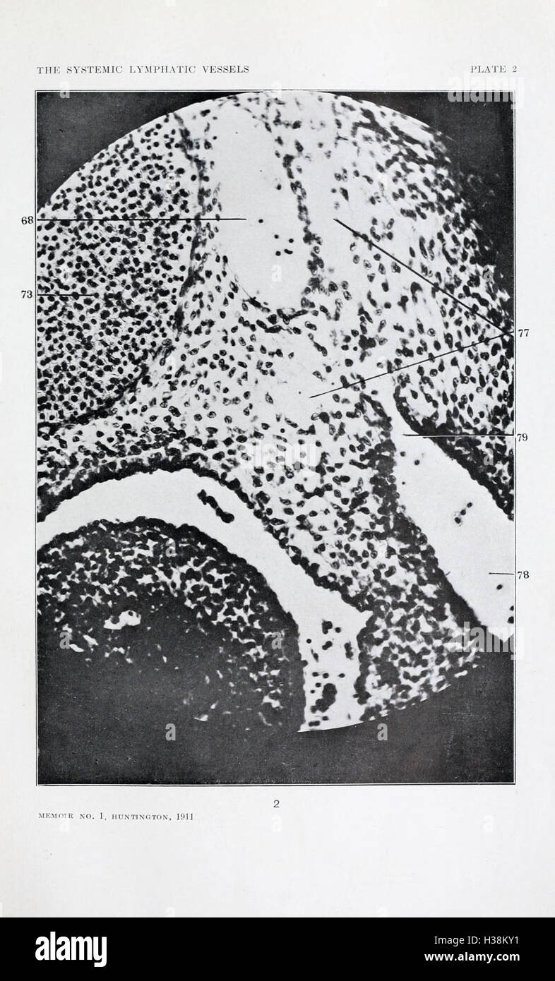 'The Anatomy and Development of the Systemic Lymphatic Vessels in the ...