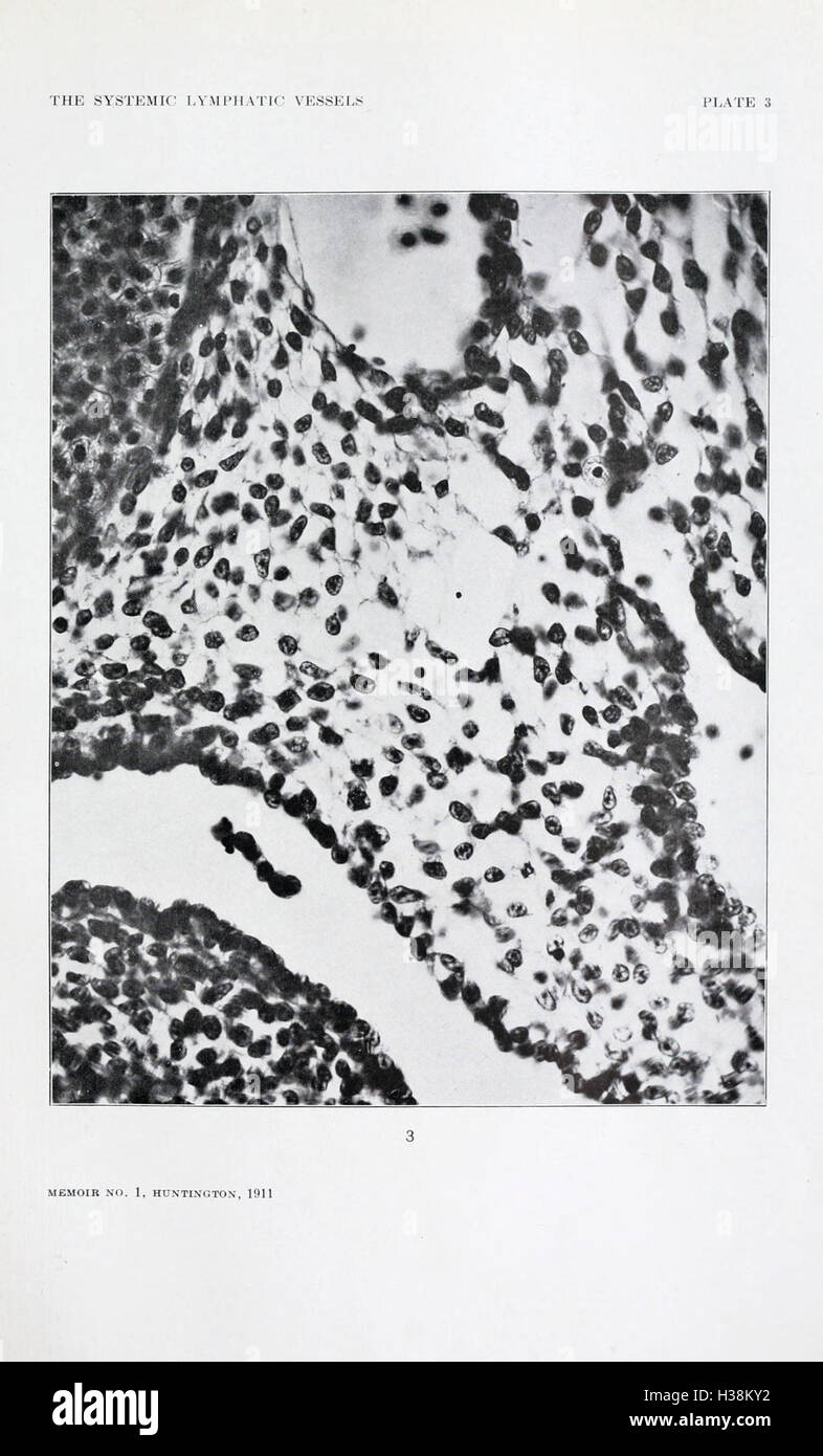 Lymph nodes function hi-res stock photography and images - Alamy