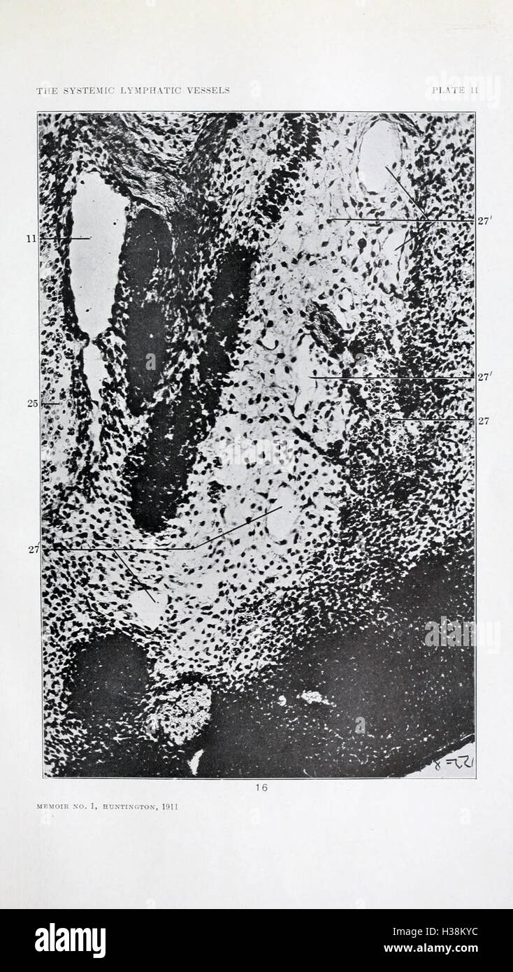 Lymph nodes function hi-res stock photography and images - Alamy