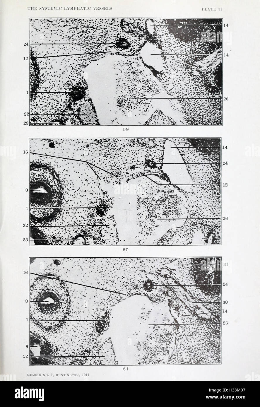 This study details the anatomy and development of the lymphatic system ...