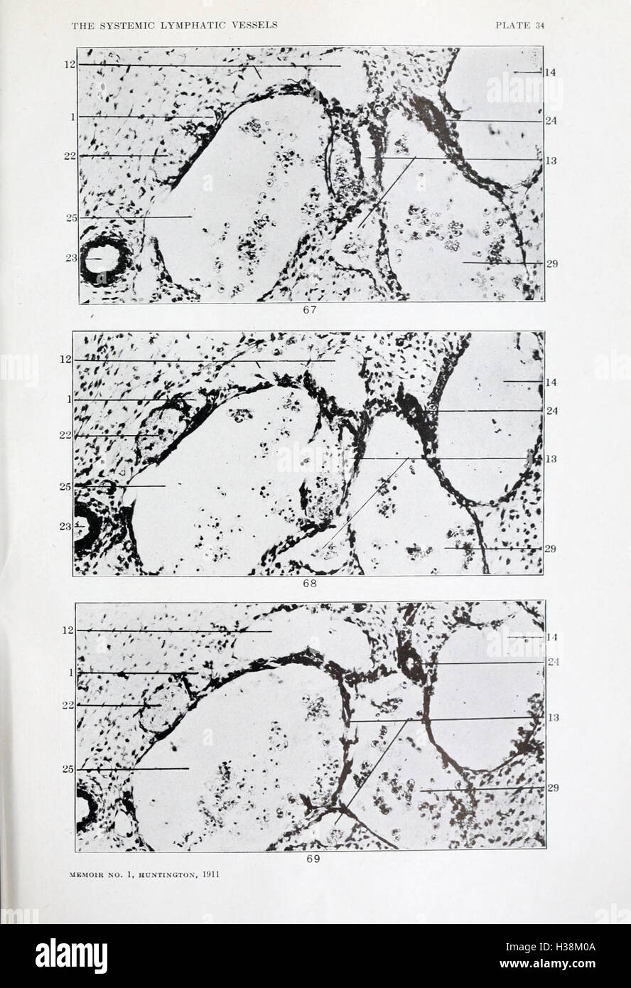 Lymph nodes function hi-res stock photography and images - Alamy