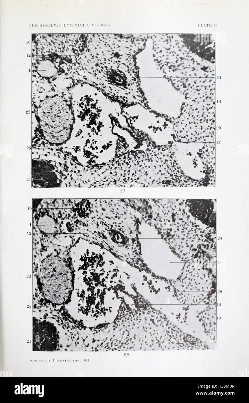 This study investigates the anatomy and development of the lymphatic ...