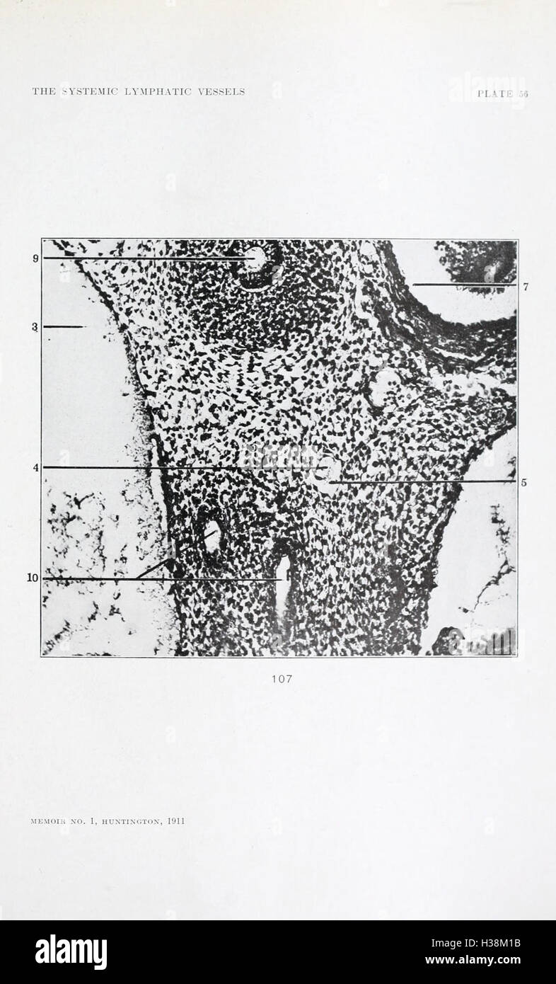 This study focuses on the anatomy and development of the lymphatic ...