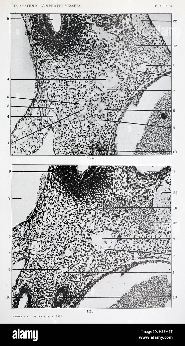 This work discusses the anatomy and growth of the systemic lymphatic ...