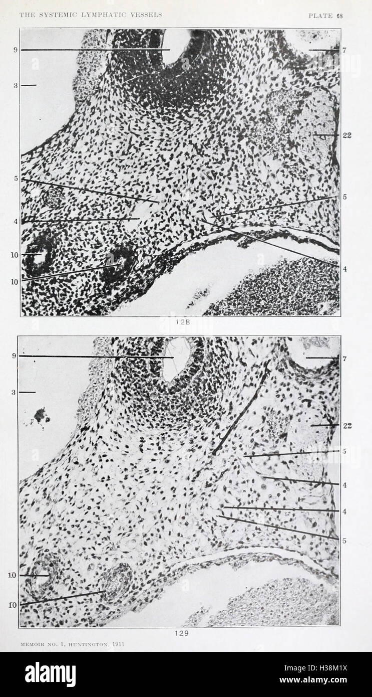 Lymph nodes function hi-res stock photography and images - Alamy