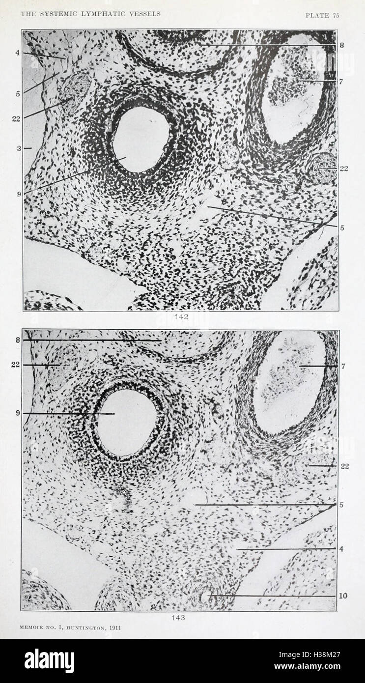 Lymph nodes function hi-res stock photography and images - Alamy