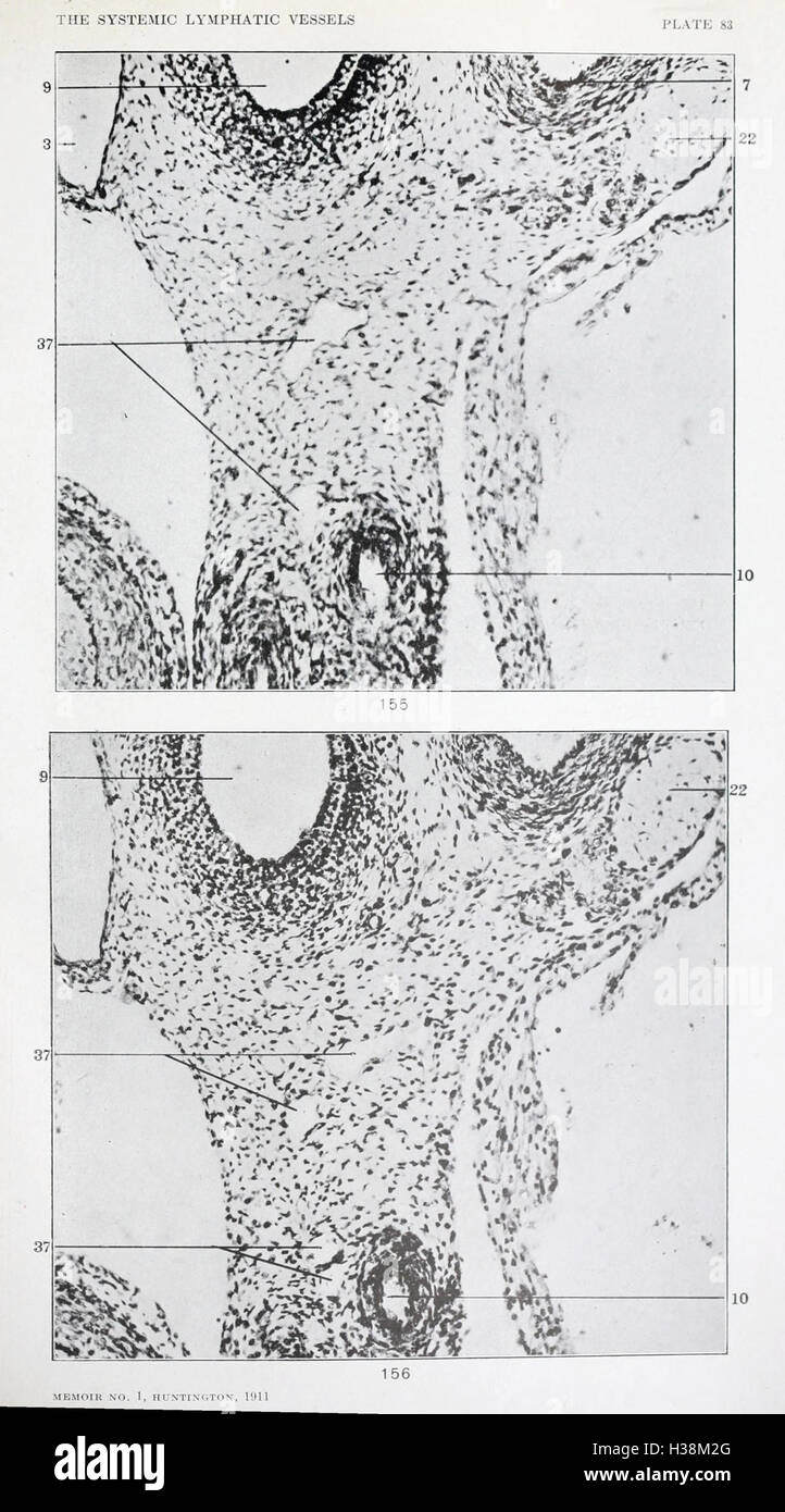 This study examines the anatomy and development of the lymphatic ...