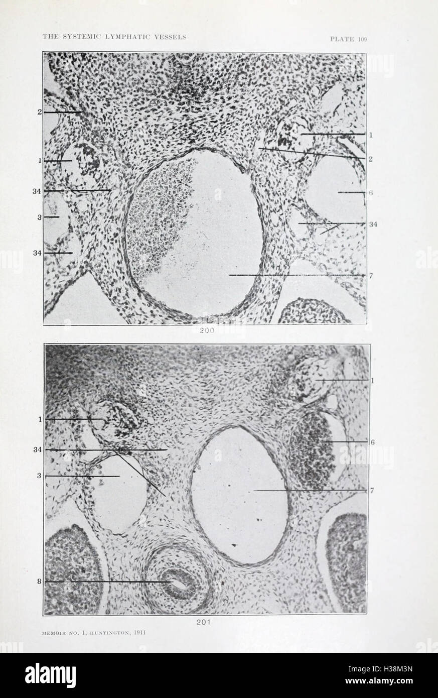 Lymph nodes function hi-res stock photography and images - Alamy