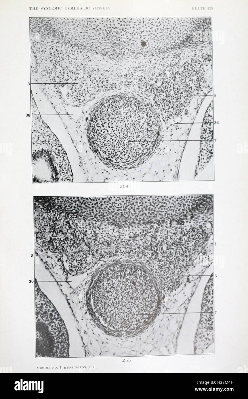 Lymph nodes function hi-res stock photography and images - Alamy