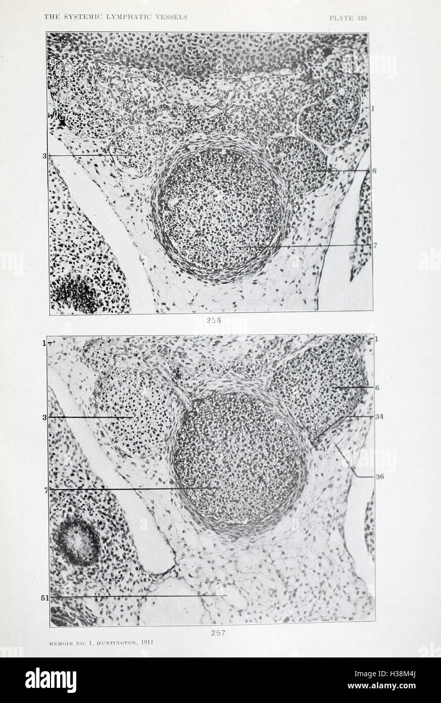 This work explores the anatomy and development of the lymphatic system ...