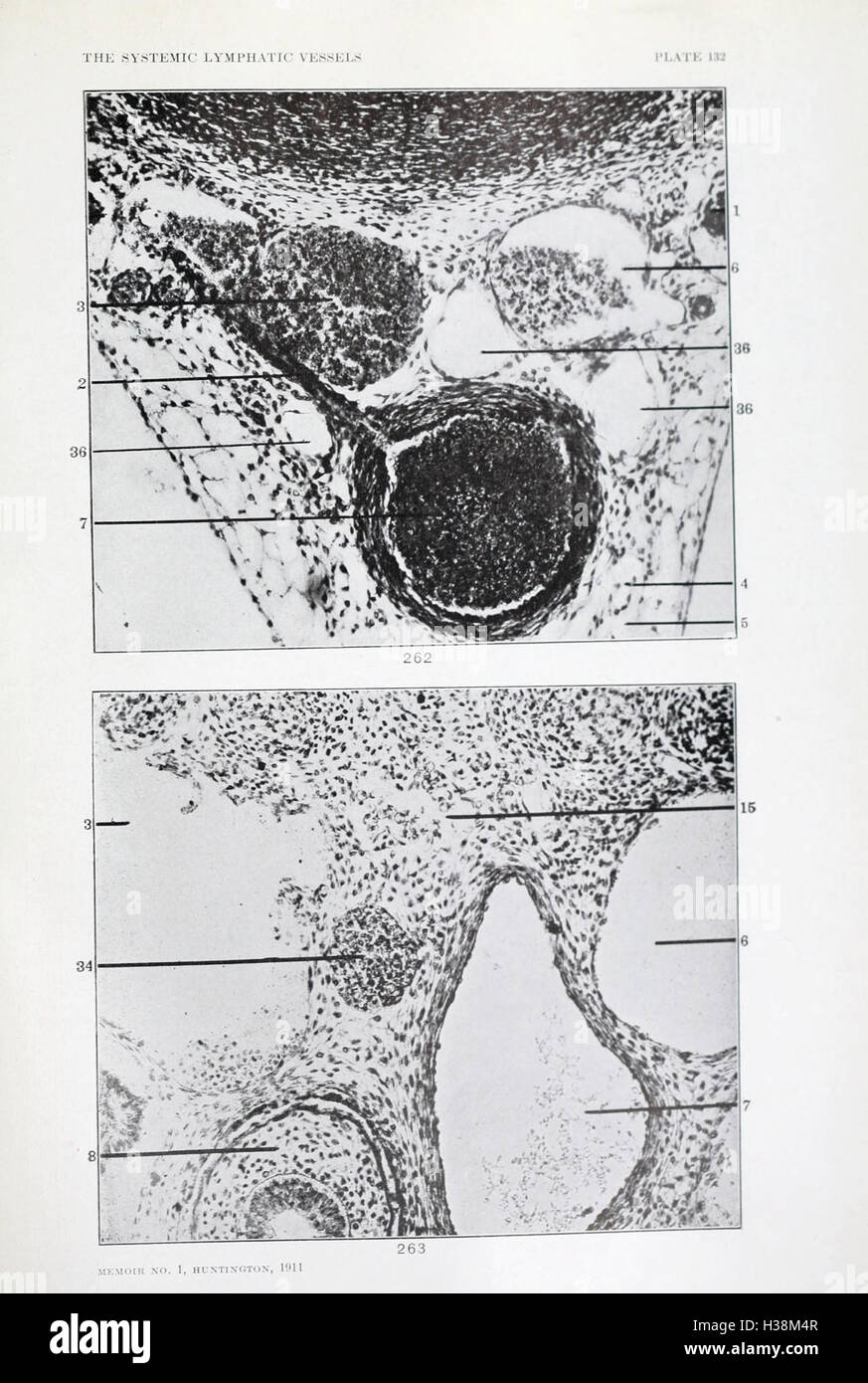 This study covers the anatomy and development of the lymphatic system ...