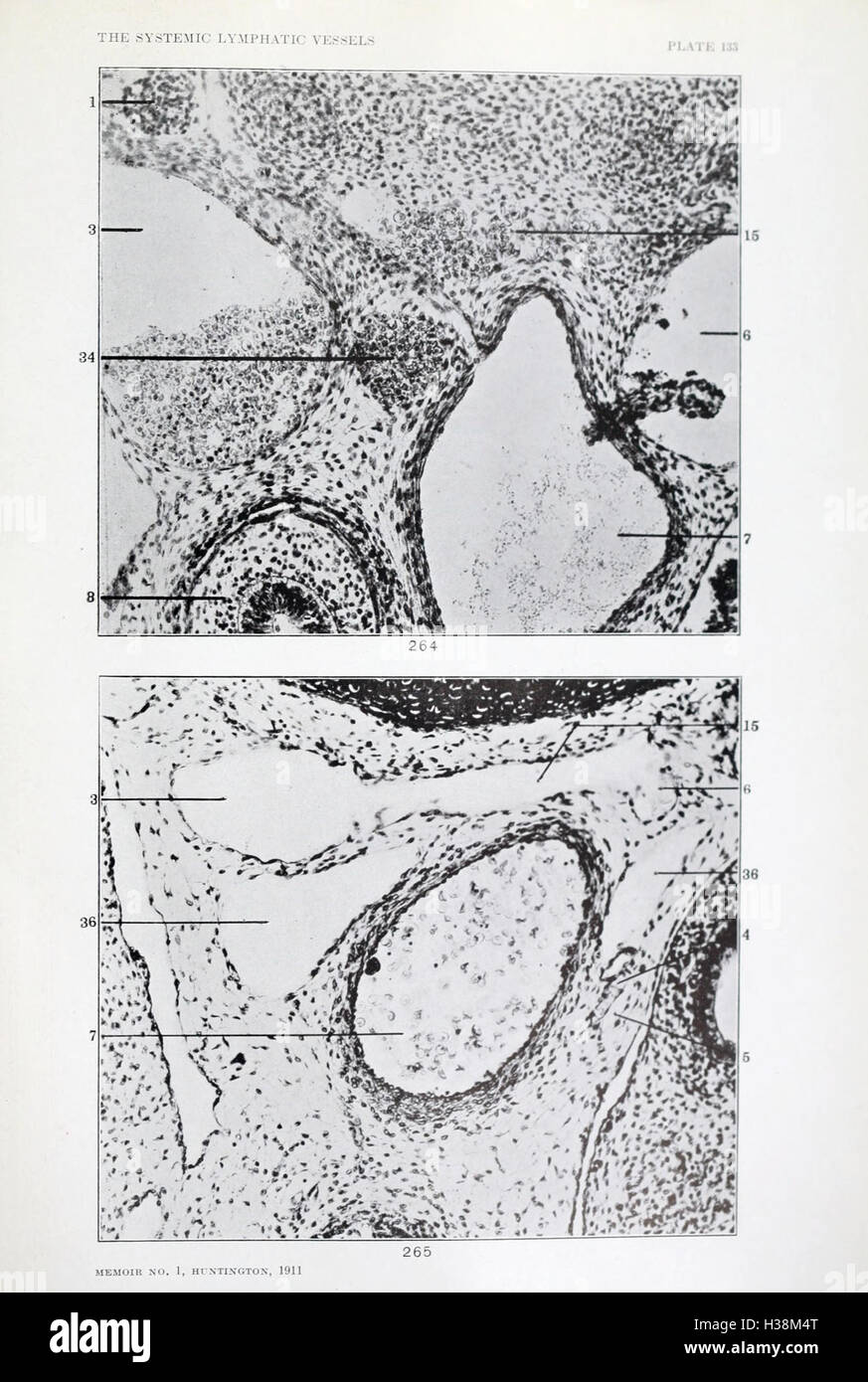 An anatomical study of the lymphatic system in domestic cats, detailing ...