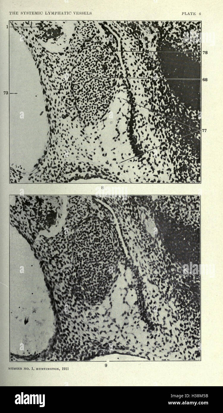 This text details the anatomy and development of the systemic lymphatic ...