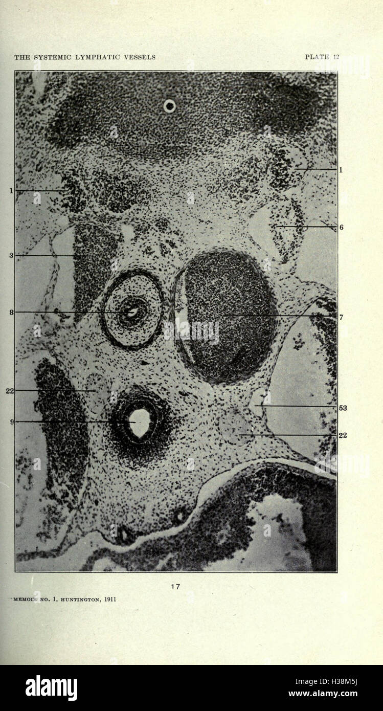 Lymph nodes function hi-res stock photography and images - Alamy