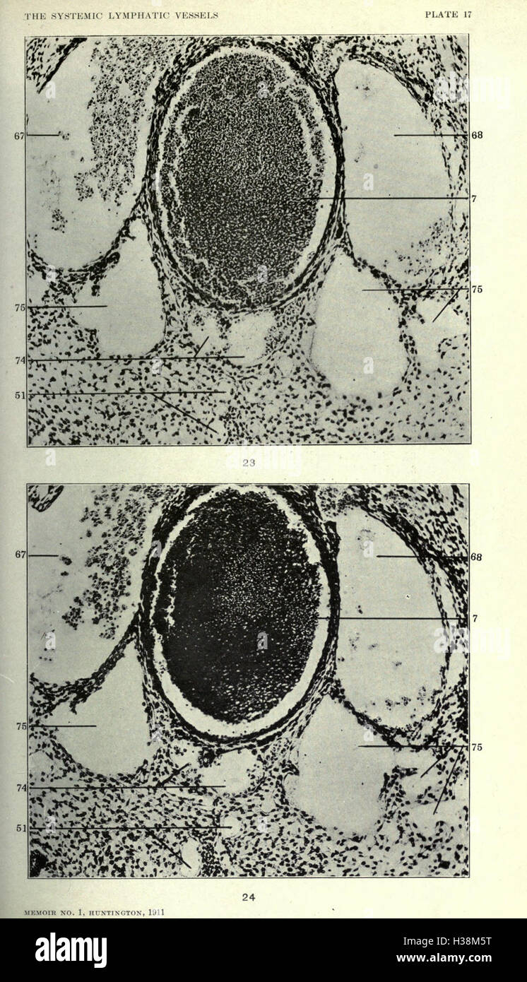 The anatomy and development of the systemic lymphatic vessels in the ...