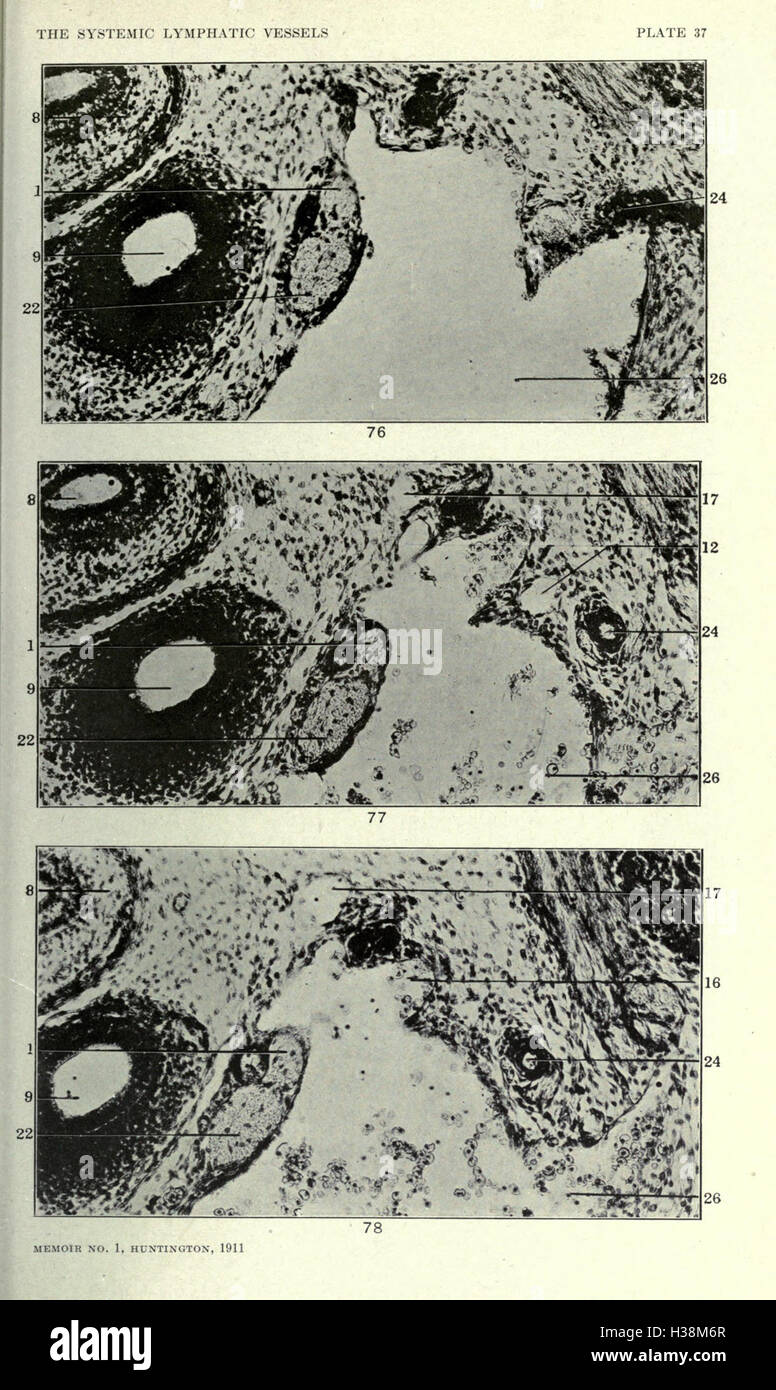 A detailed study on the anatomy and development of the lymphatic system ...