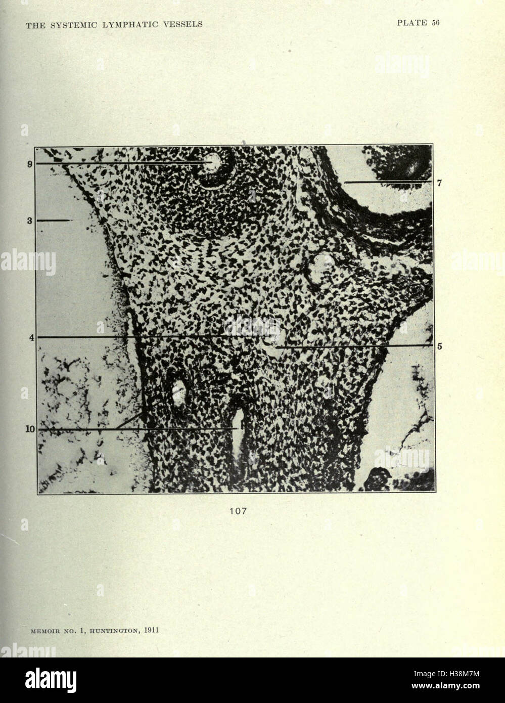 Lymph nodes function hi-res stock photography and images - Alamy