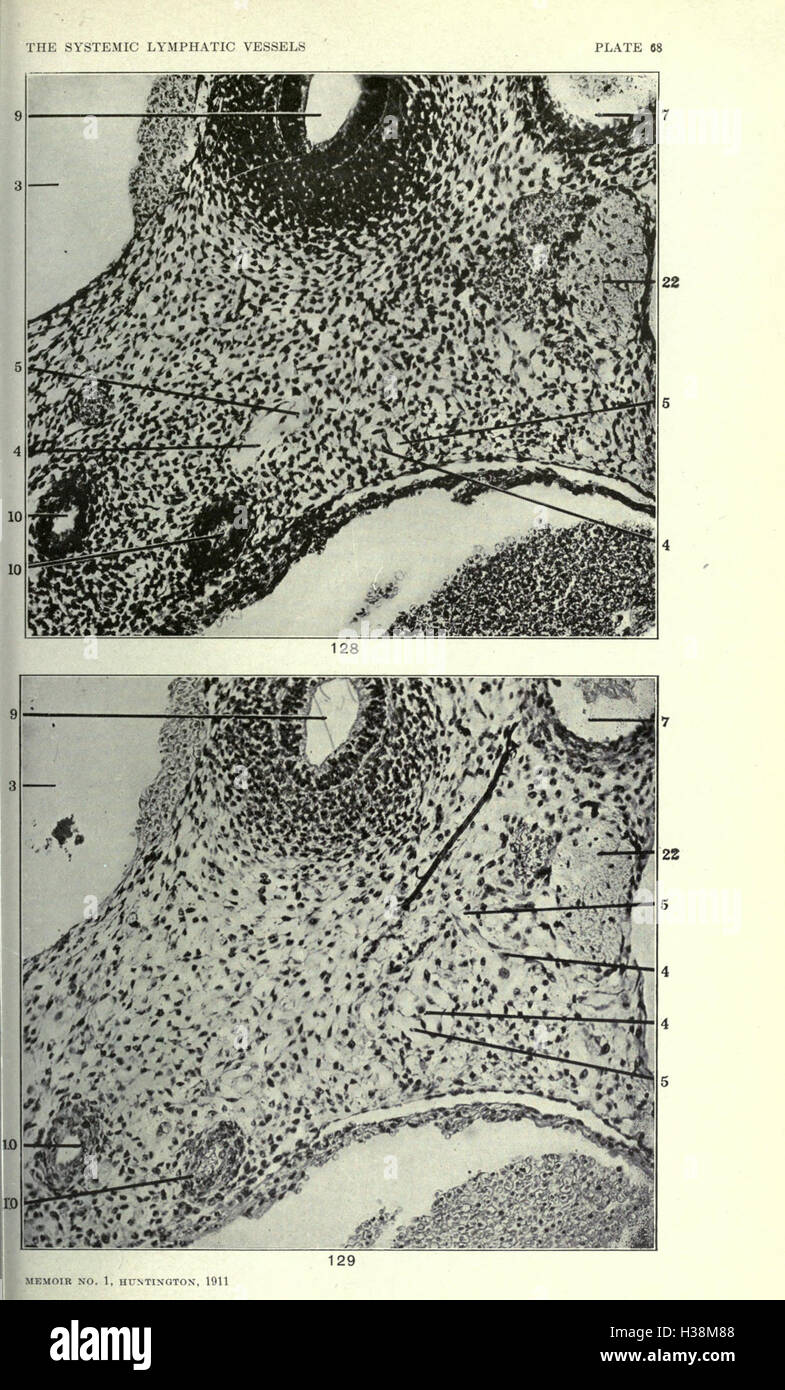 This study focuses on the anatomy and development of the lymphatic ...
