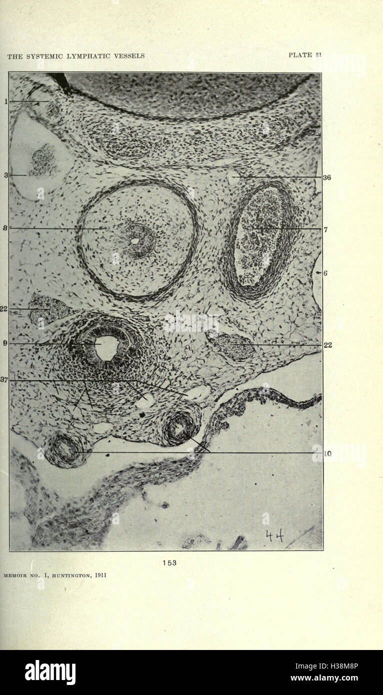 A study on the anatomy and development of the lymphatic system in ...