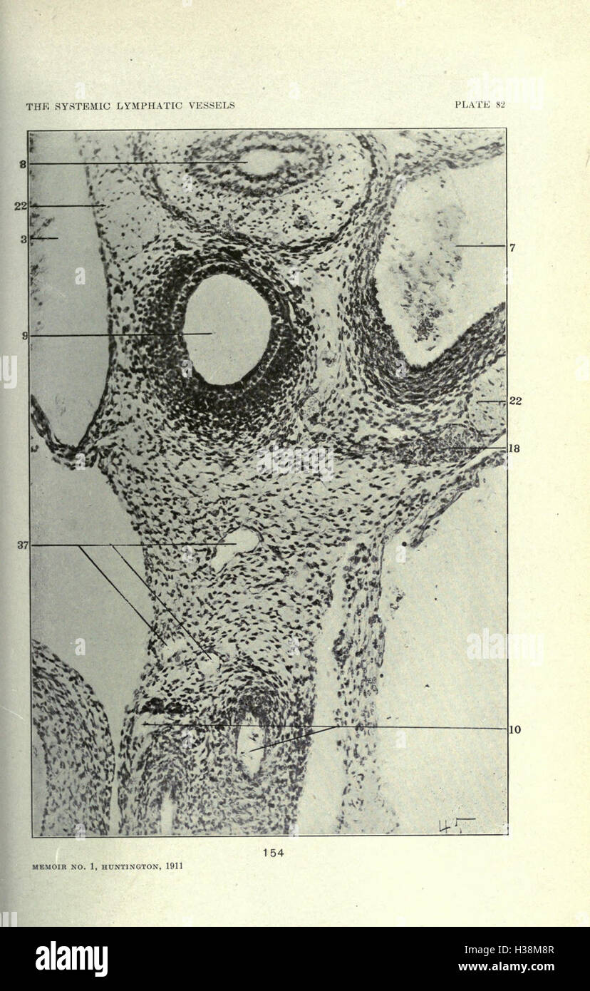 This study explores the anatomy and development of the lymphatic system ...