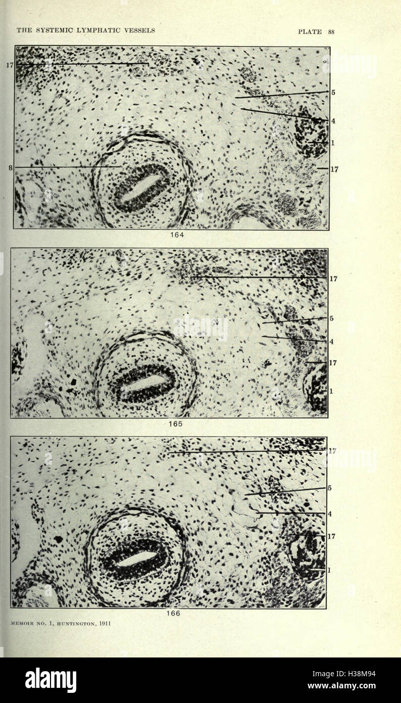 Lymphatic mapping hi-res stock photography and images - Alamy