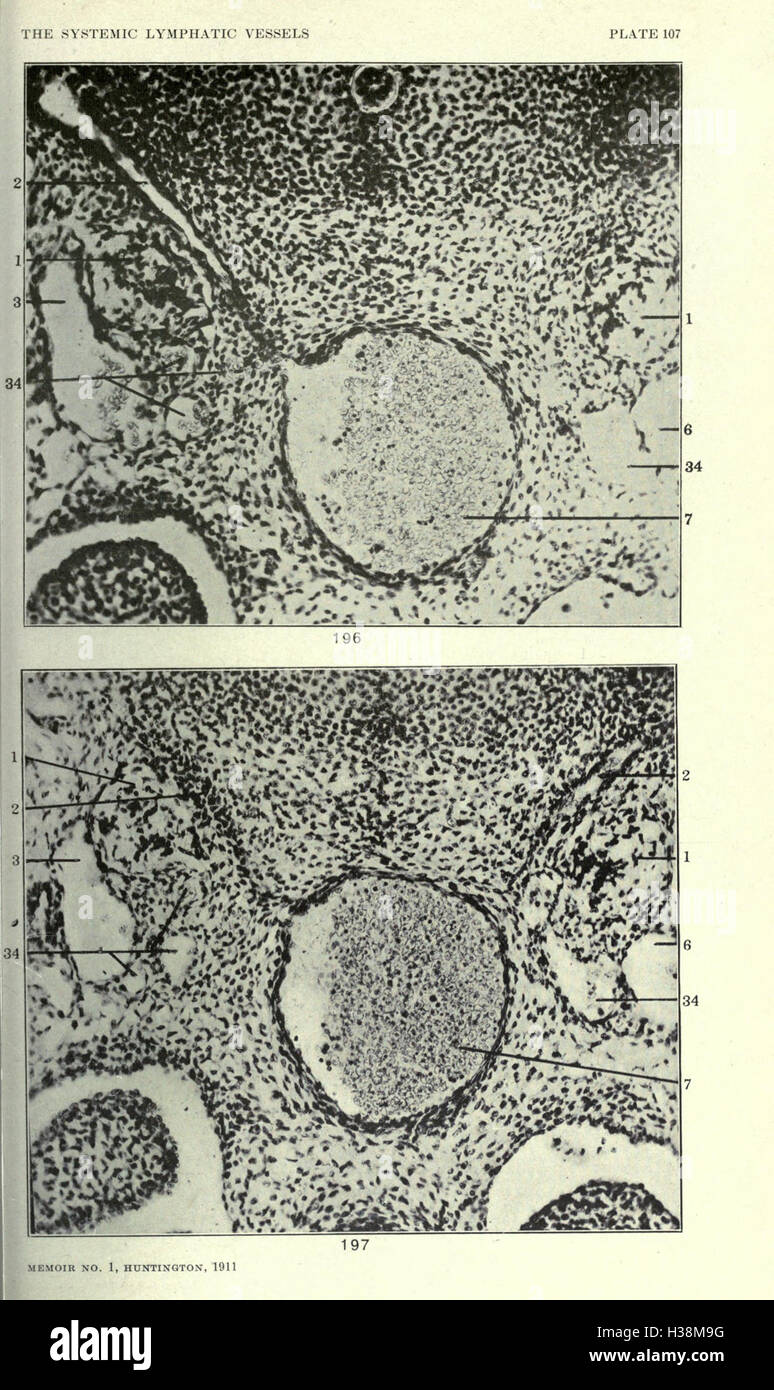 Lymph nodes function hi-res stock photography and images - Alamy
