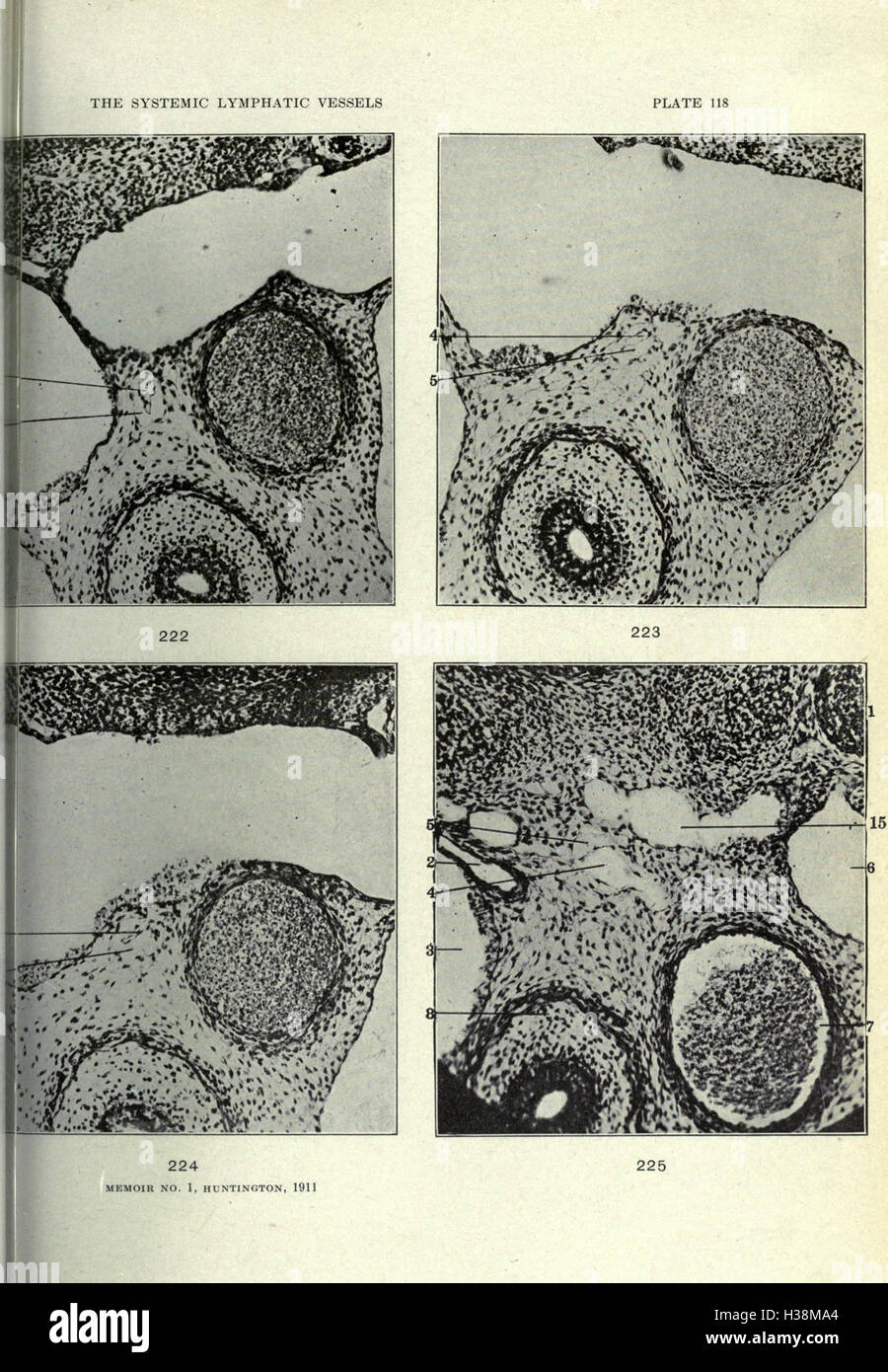 This work provides a detailed exploration of the systemic lymphatic ...