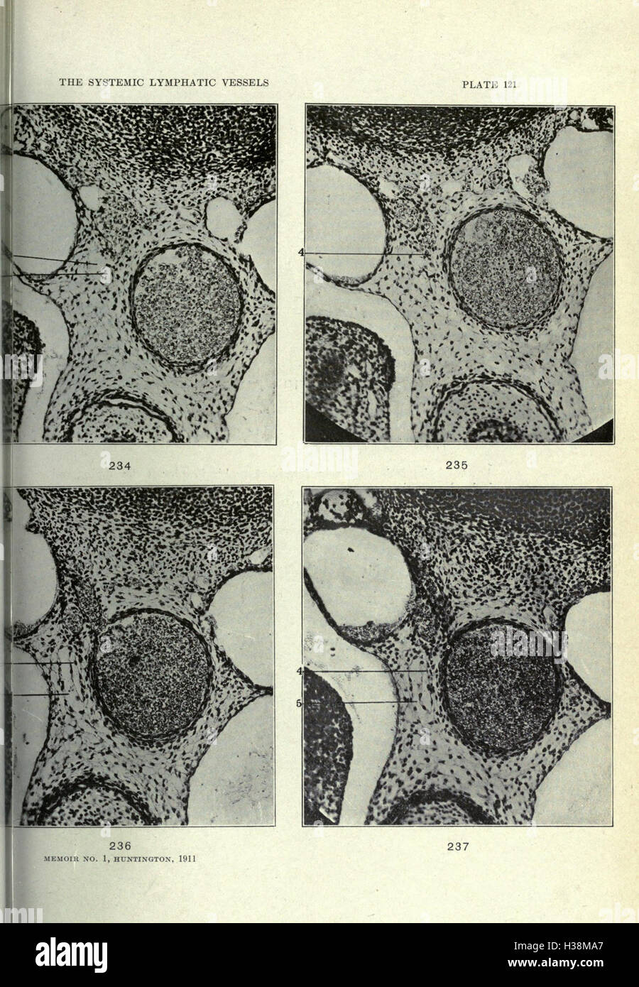 This work examines the anatomy and development of the lymphatic system ...