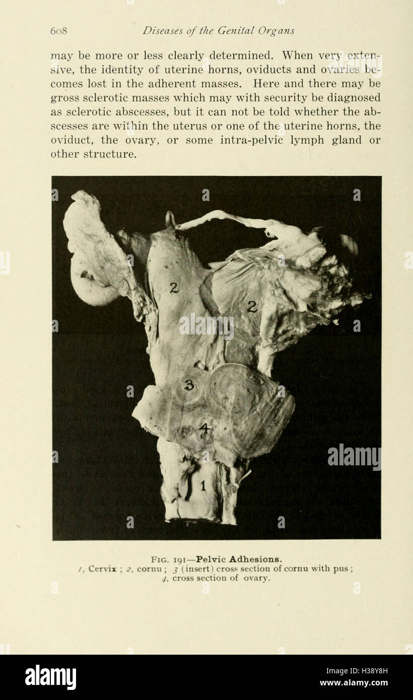 This text addresses various diseases affecting the reproductive systems ...