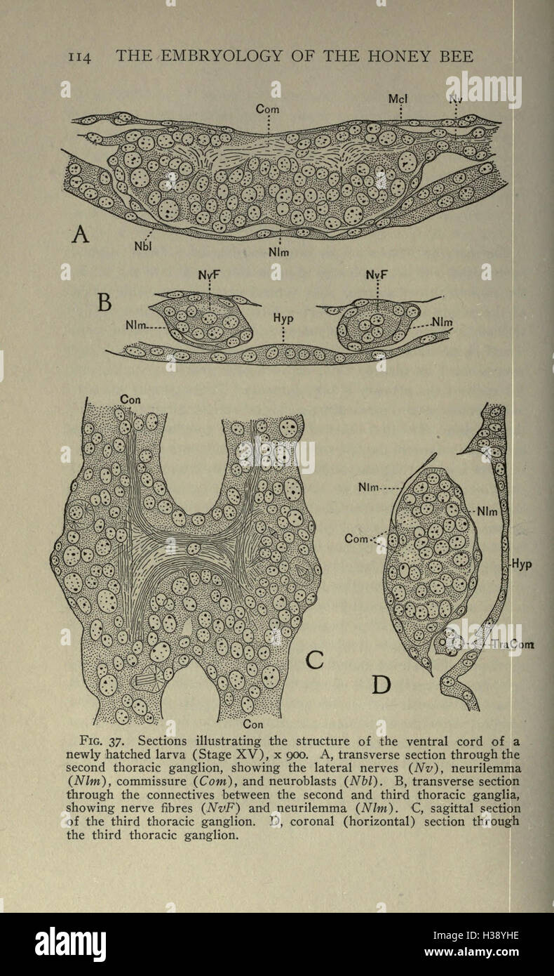 Reproductive anatomy highlighting hi-res stock photography and images ...