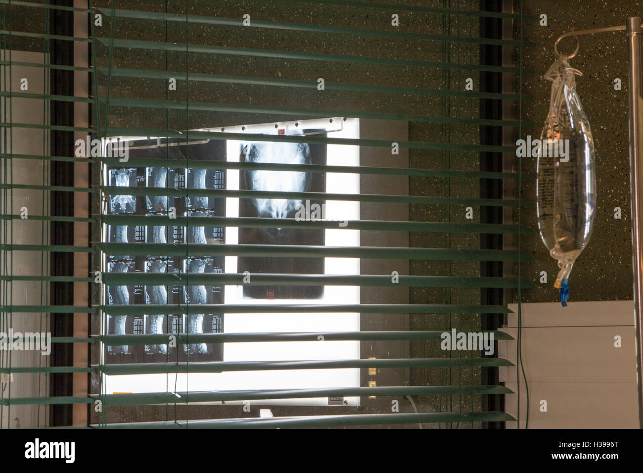 X rays on hospital lightbox hi-res stock photography and images - Alamy