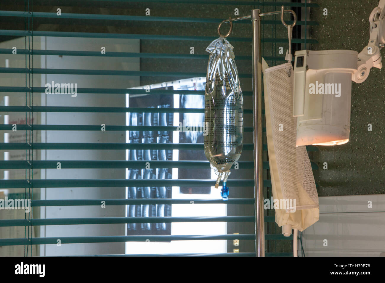 X-Rays on a hospital lightbox Stock Photo - Alamy