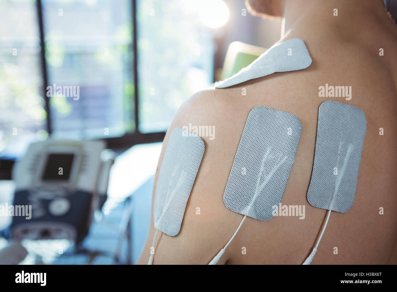 Male patient with electro stimulator electrodes on his back Stock Photo ...