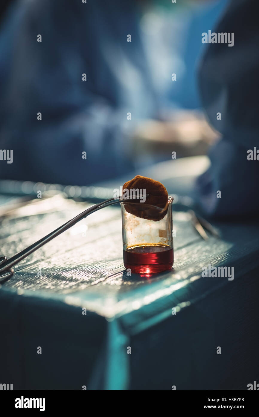 Sample of blood drained in a container in operation room Stock Photo ...