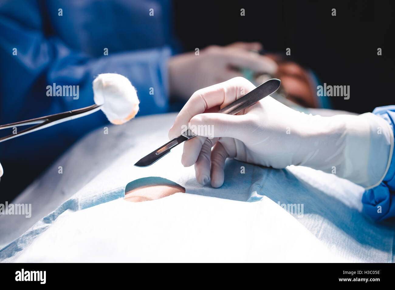 Operation blade hi-res stock photography and images - Alamy