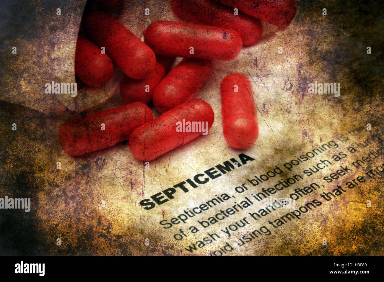 Septicemia High Resolution Stock Photography and Images - Alamy