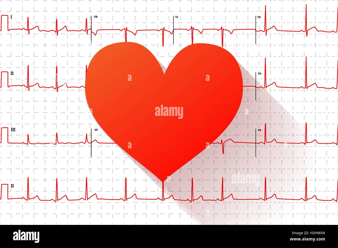 Normal heart rate cardiac ecg hi-res stock photography and images - Alamy