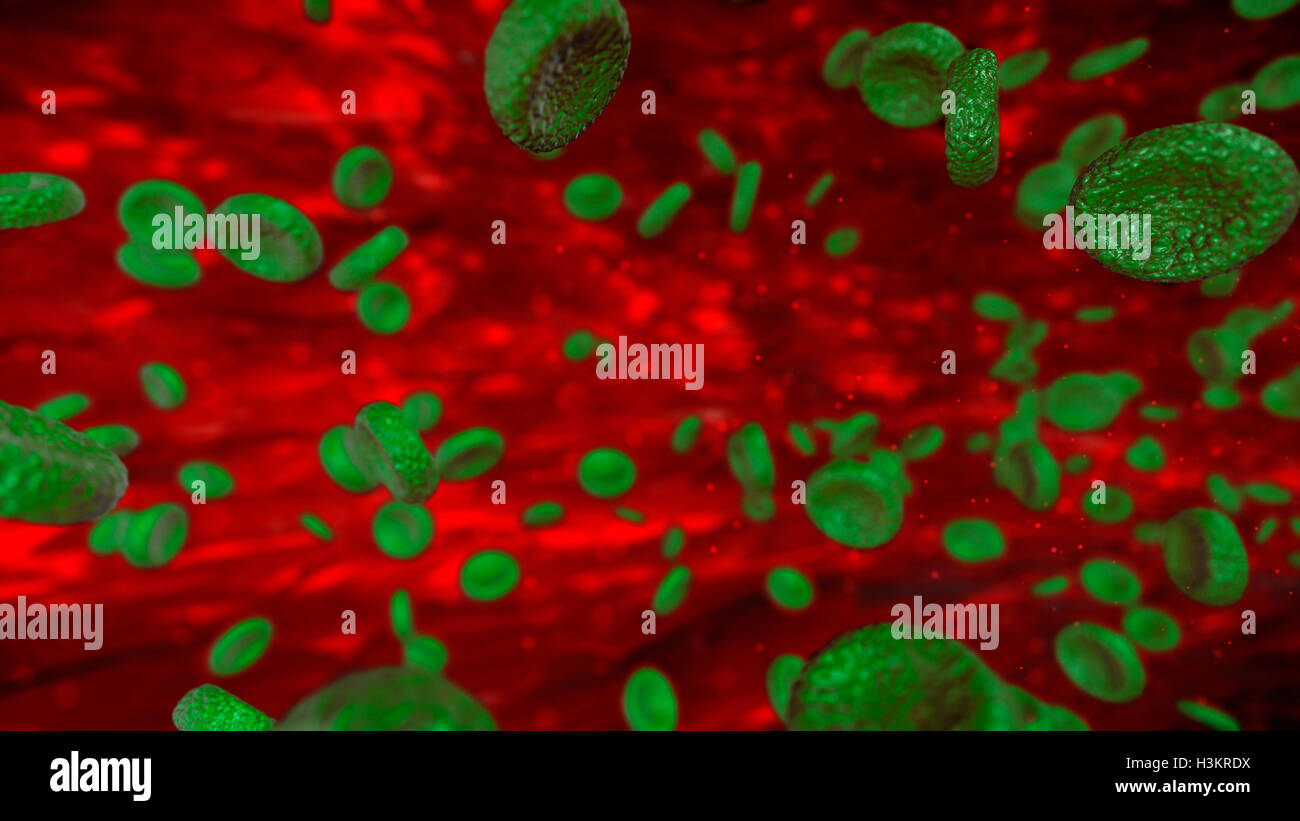 Infected blood cells in artery. Virus with streaming blood cells in ...