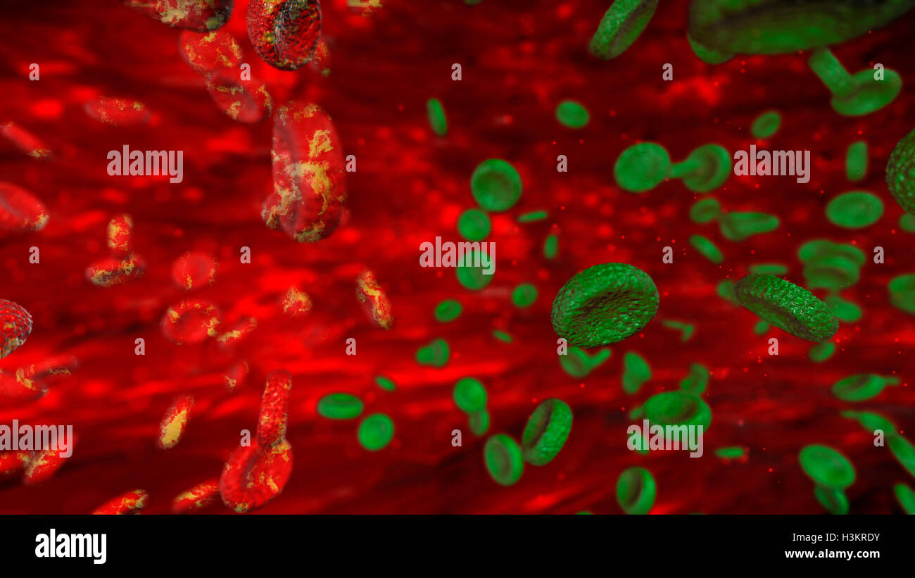 Infected blood cells in artery. Virus with streaming blood cells in ...