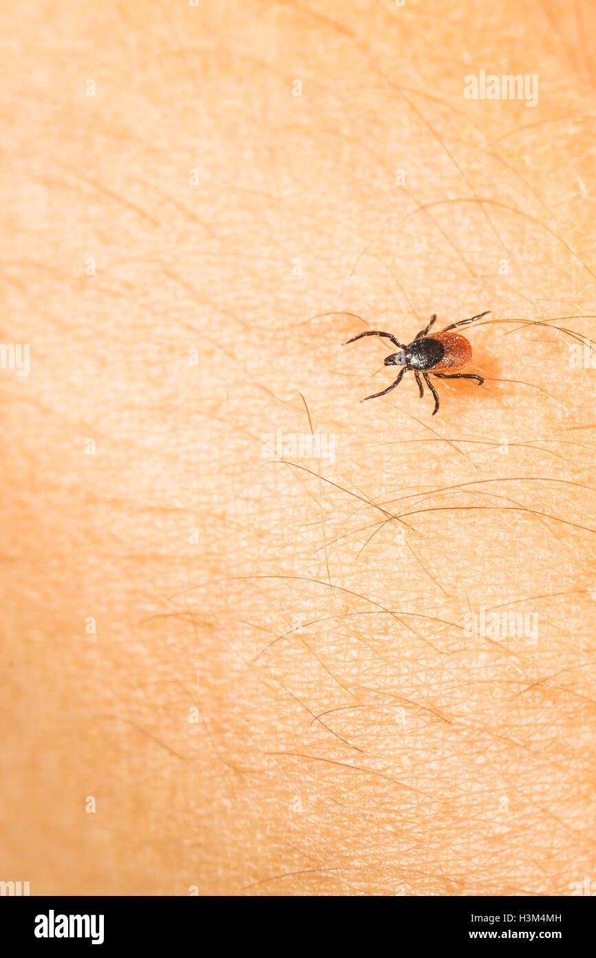 Tick - sucking carrier of various diseases Stock Photo - Alamy