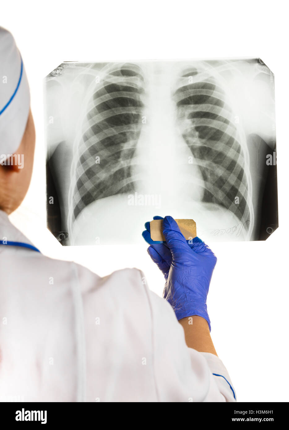 Chest x ray scan hi-res stock photography and images - Alamy