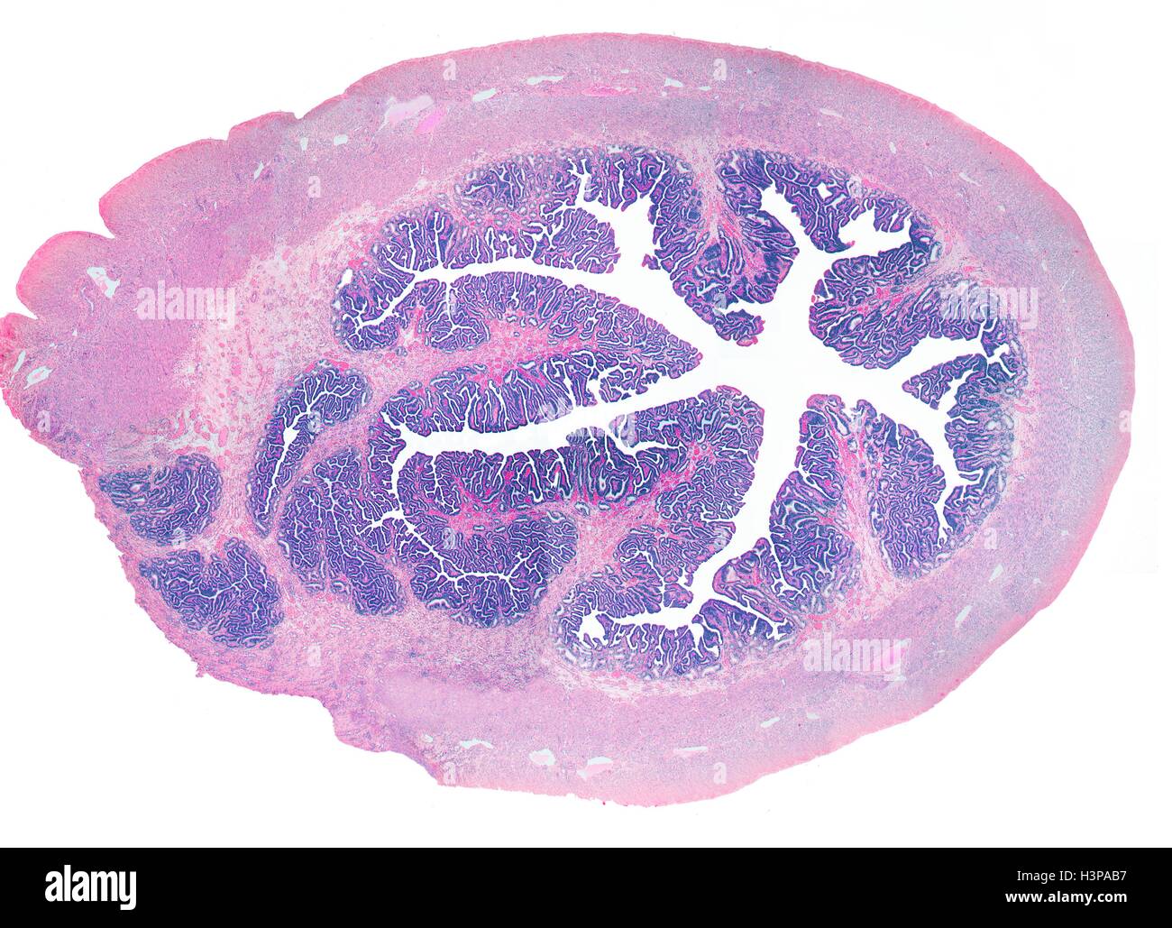 Fallopian tubes hi-res stock photography and images - Alamy