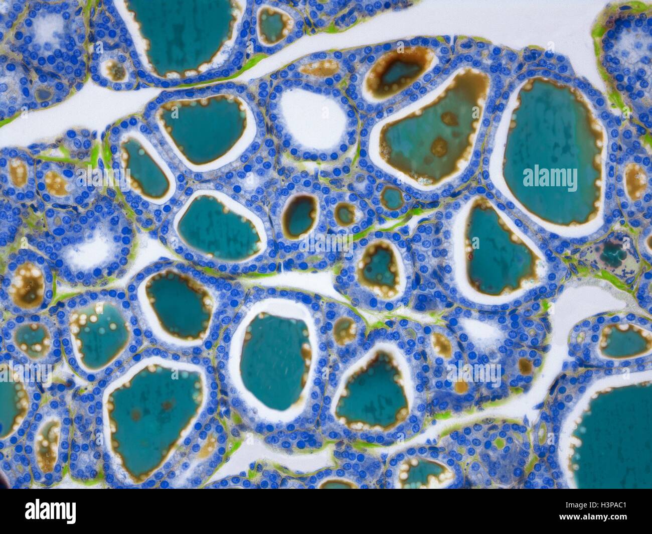 Thyroid gland. Light micrograph (LM) of a thyroid gland showing the ...