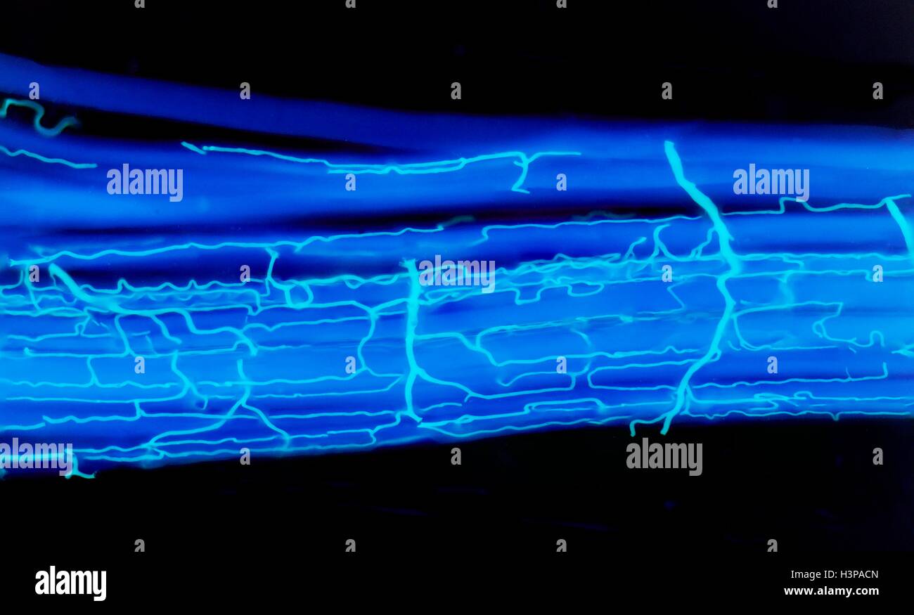 Blood capillaries muscle hi-res stock photography and images - Alamy