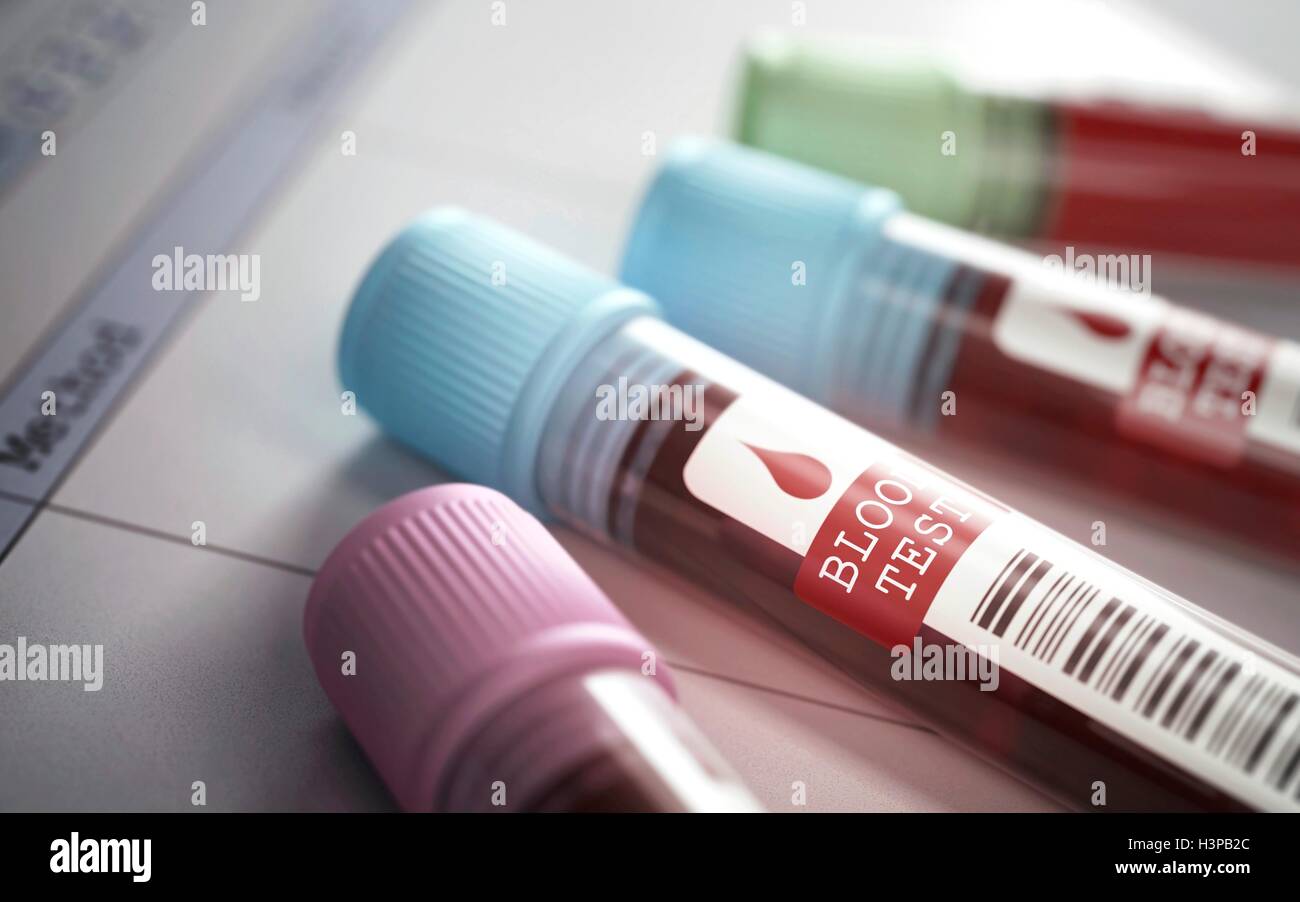 Blood samples in blood test tubes Stock Photo - Alamy